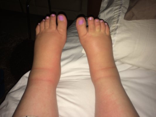 Eat with CHUNKY Feet