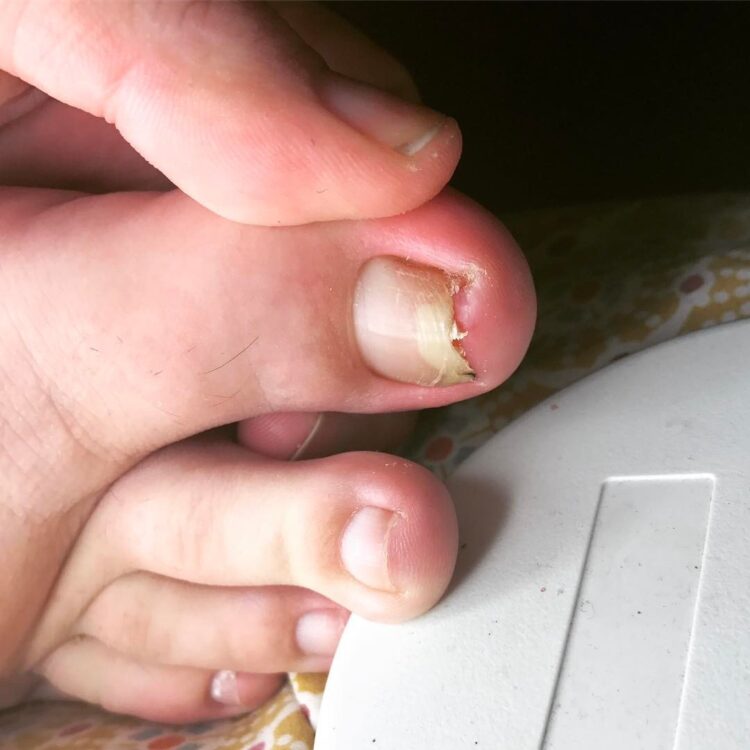 Jordan Raskopoulos Feet