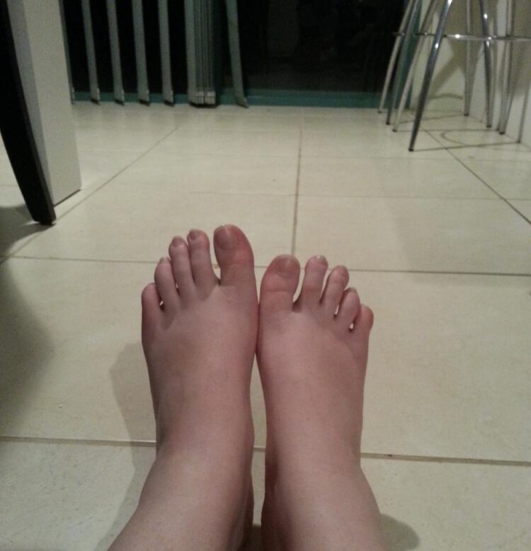 Kleetho Feet